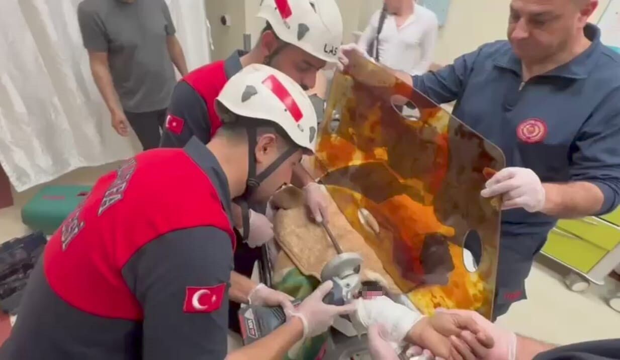 Koluna saplanan demir şişle ameliyata alındı - Sonses.tv – Mersin Son ...